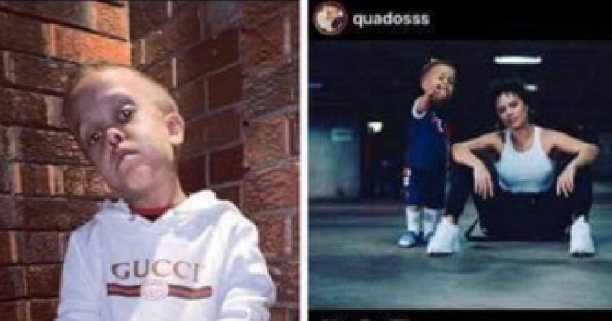 Niño con enanismo matoneado en Australia ahora es víctima de las fake ...